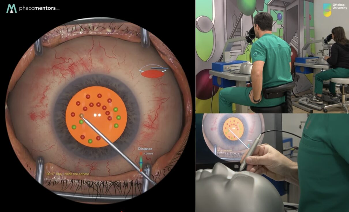 Cataract surgery Fundamentals and check list - Oftalmo University
